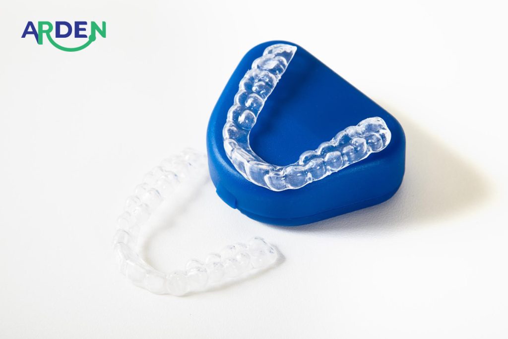 Kenapa Perlu Pakai Retainer Selepas Pakai Braces? - Klinik Gigi Arden